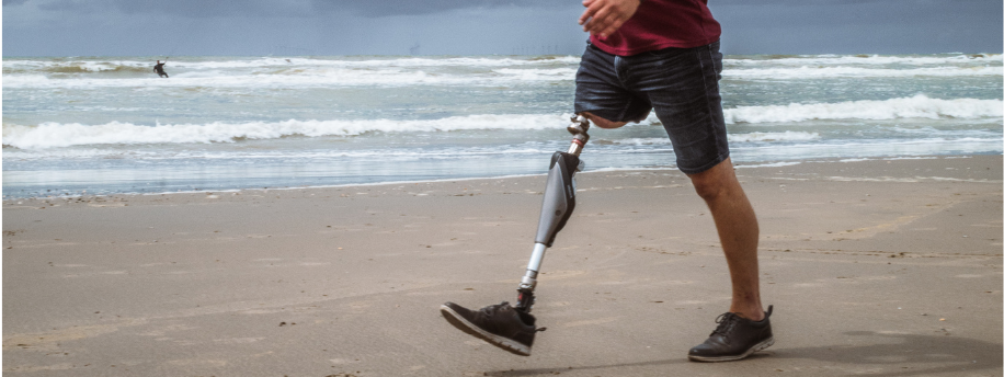 Endo-Exo-Prothese | Knochenverankerte Prothesenlösung